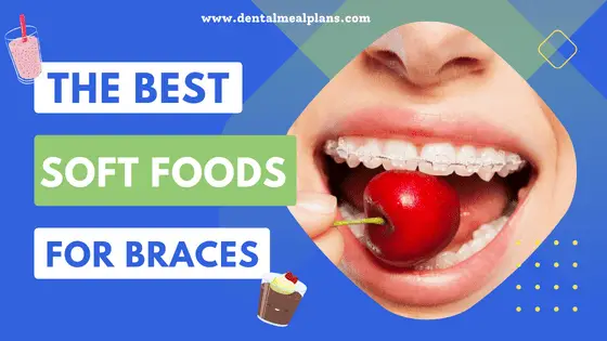Soft Foods To Eat For Braces [Free Sample Meal Plan] - Dental Meal Plans
